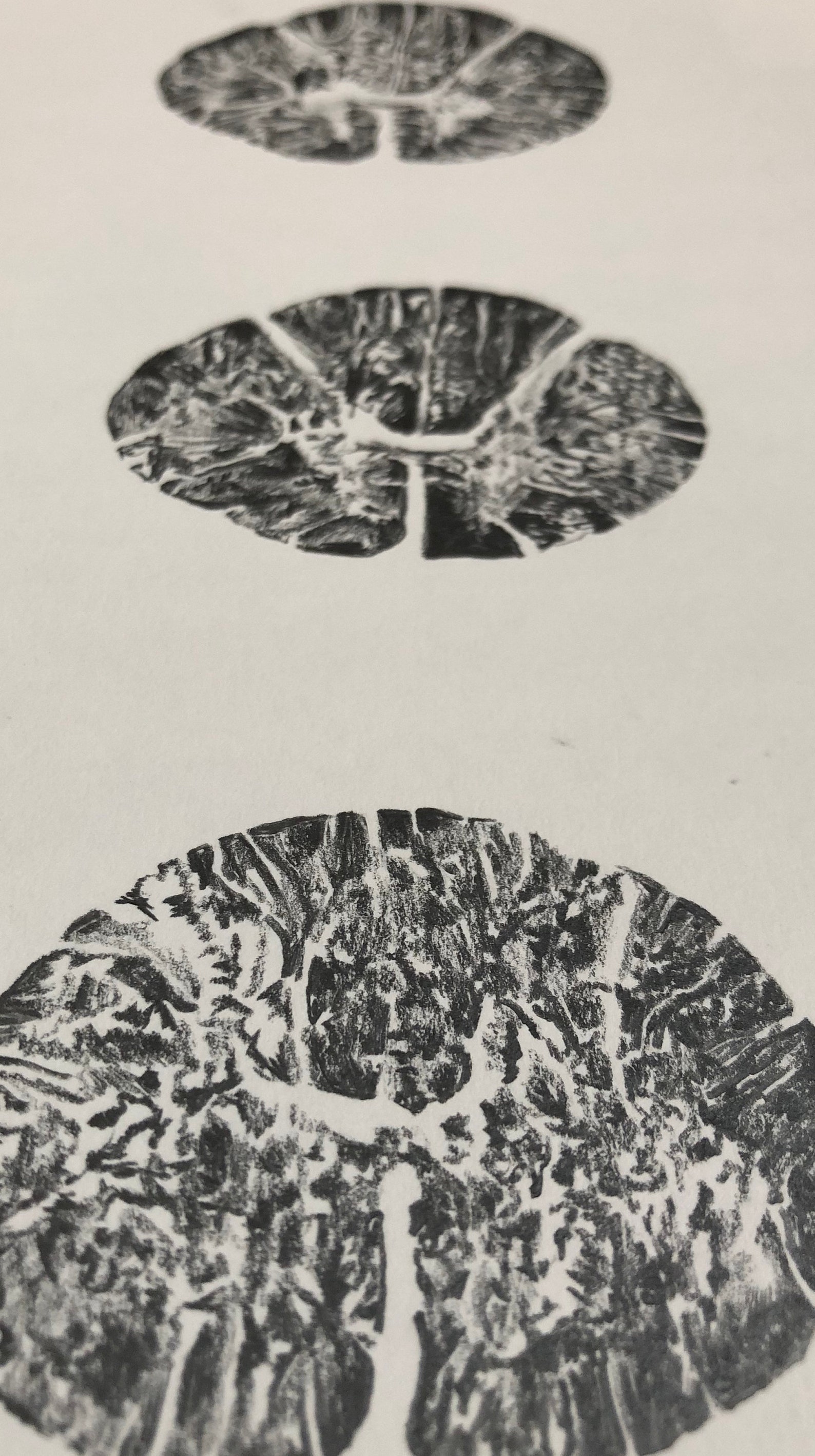 Anatomical Drawing Neuroscience Drawing Anatomy Art Spinal | Etsy