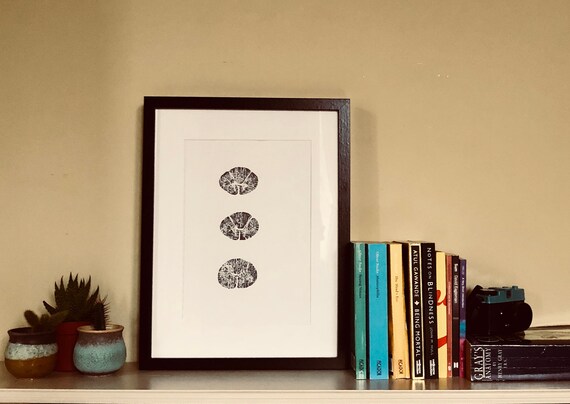 Anatomical Drawing Neuroscience Drawing Anatomy Art Spinal | Etsy