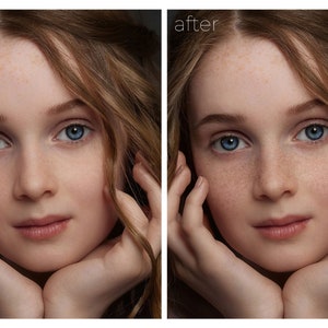 Freckles Overlays PNG on Transparent Background Portrait Photoshop ...