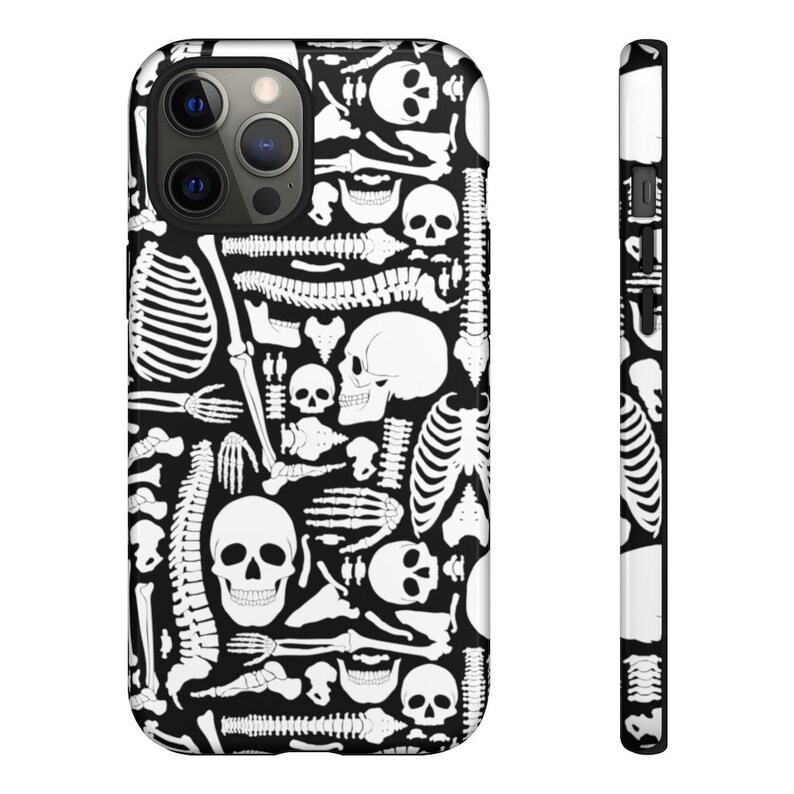 Skeleton Phone Case Iphone Case Samsung Galaxy Case - Etsy