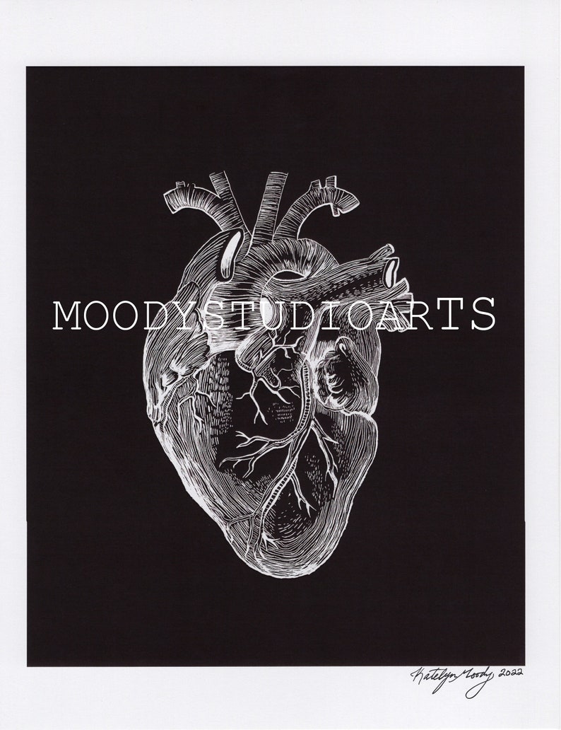 Anatomical Heart Artist Signed Print - Etsy
