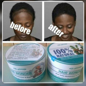 Hair Wonder wholesale Cream Hair Loss