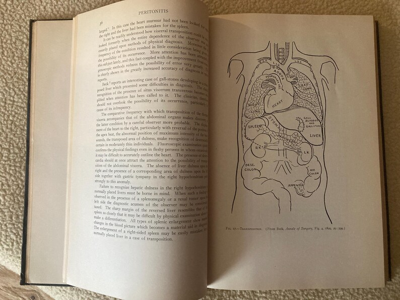 Antique Peritonitis Medical Reference Book Fred J Garland Sherrill ...
