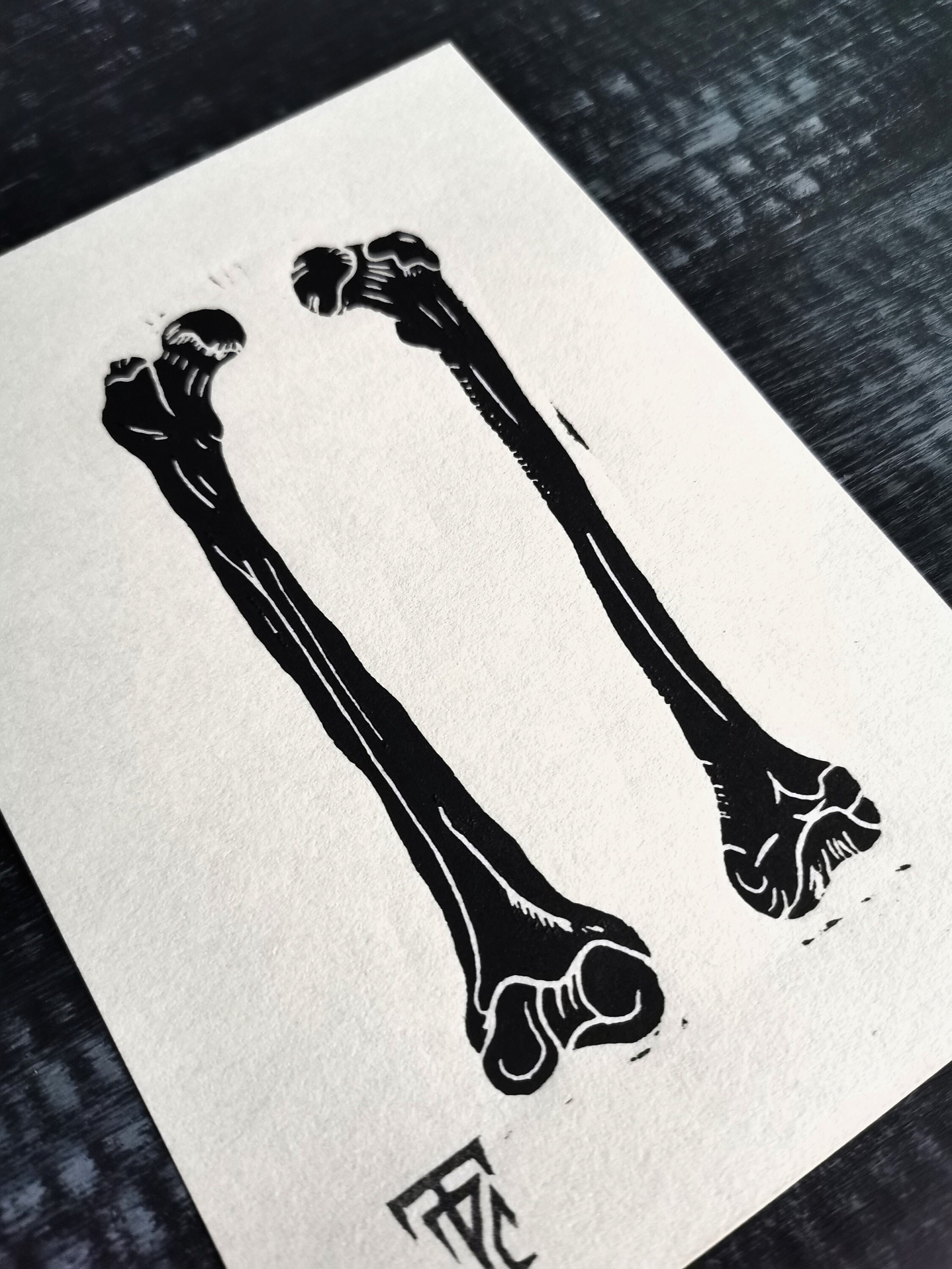 Bones Original Linocut Print || Hand Printed || Anatomy Linocut ...