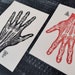 Anatomical Hand Original Linocut // Anatomy Linoprint - Etsy