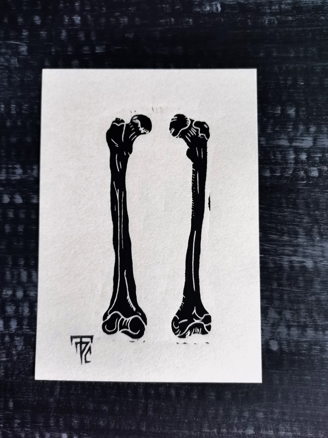 Bones Original Linoprint Anatomy Linocut Skeleton - Etsy