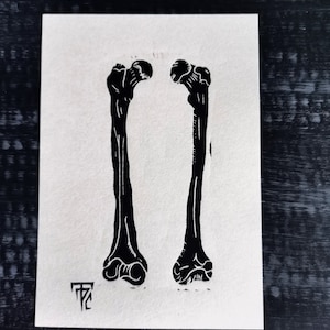 Bones Original Linocut Print || Hand Printed || Anatomy Linocut ...