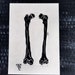 Bones Original Linocut Print || Hand Printed || Anatomy Linocut ...
