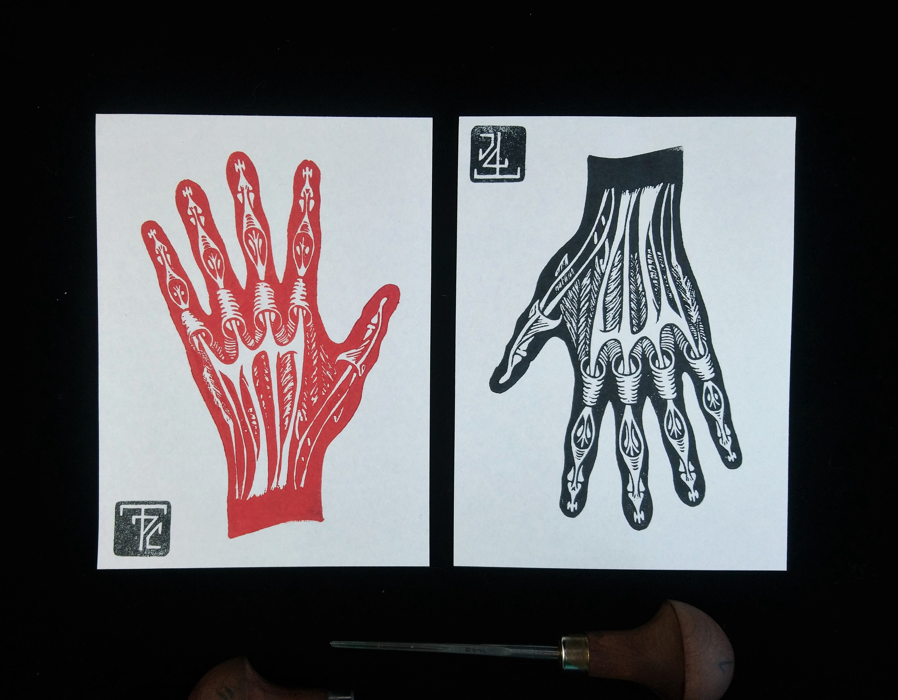 Anatomical Hand Original Linocut // Anatomy Linoprint | Etsy