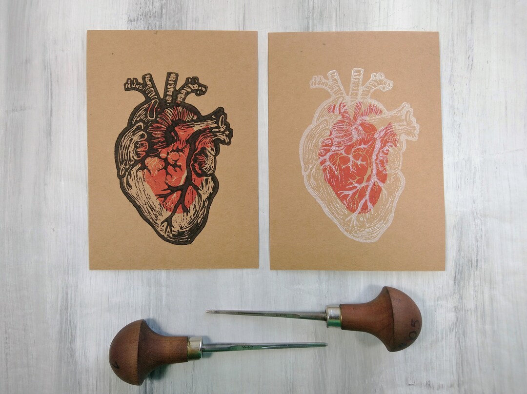 Anatomical Heart Card // Human Anatomy Postcard // Linocut Greeting ...