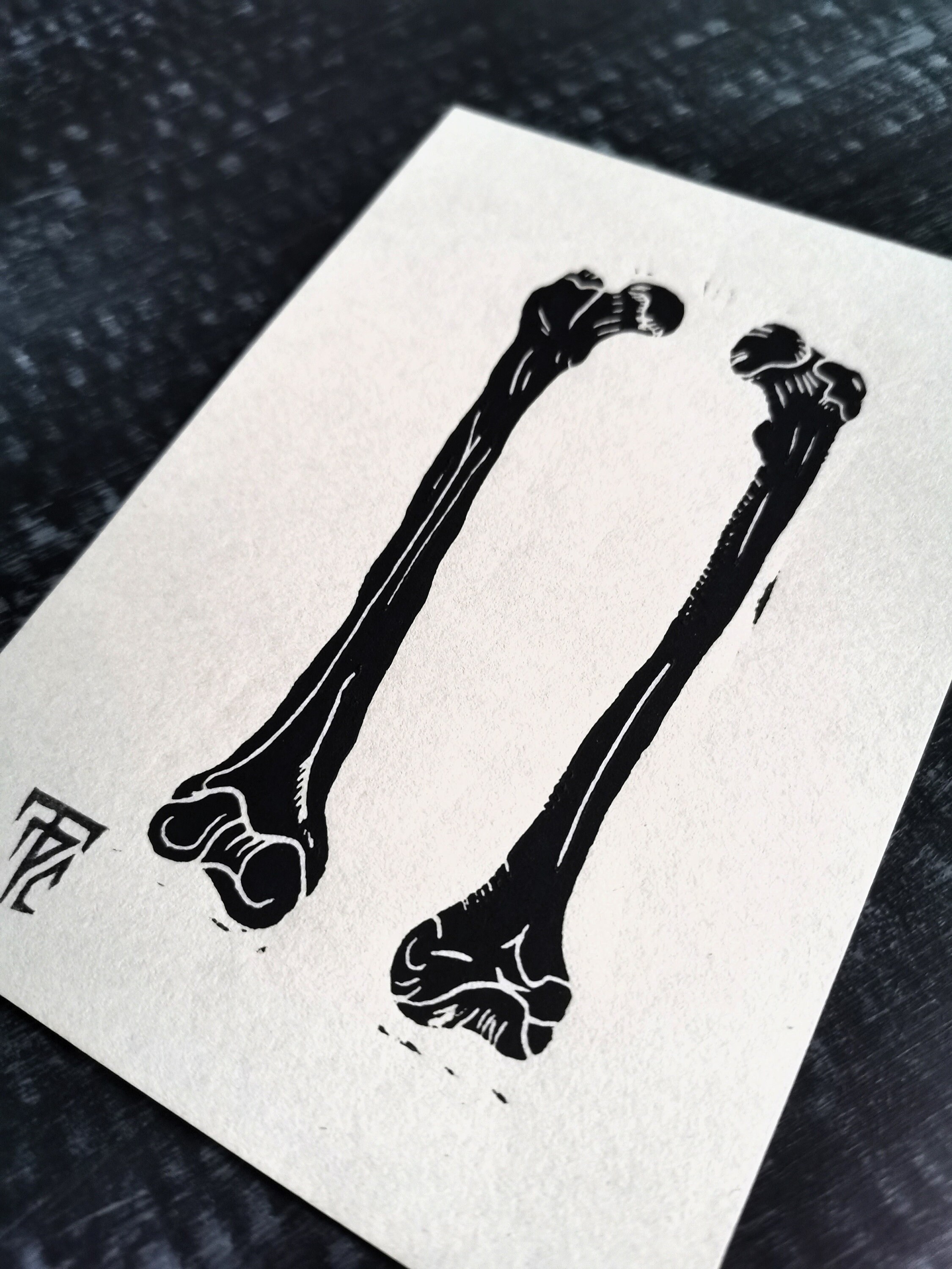 Bones Original Linocut Print || Hand Printed || Anatomy Linocut ...