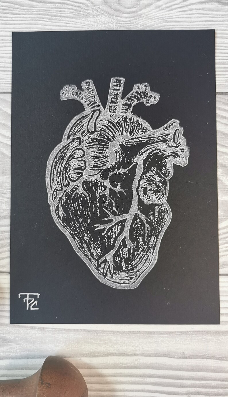 Anatomical Heart Original Linocut // Anatomy Linoprint - Etsy