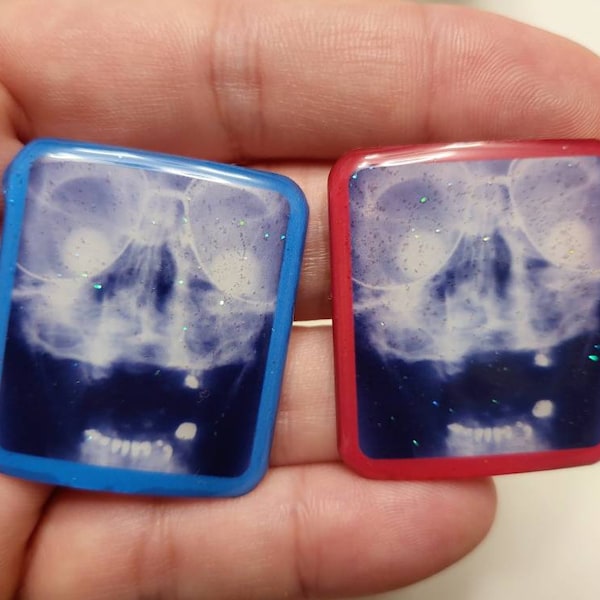 Xray Markers With Initial - Etsy