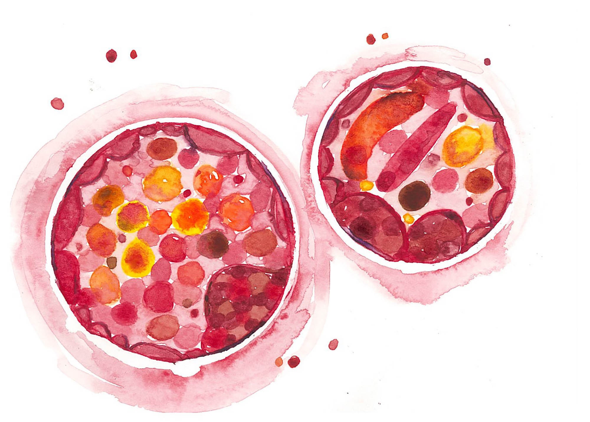 Custom Embryo Watercolor Painting - Etsy
