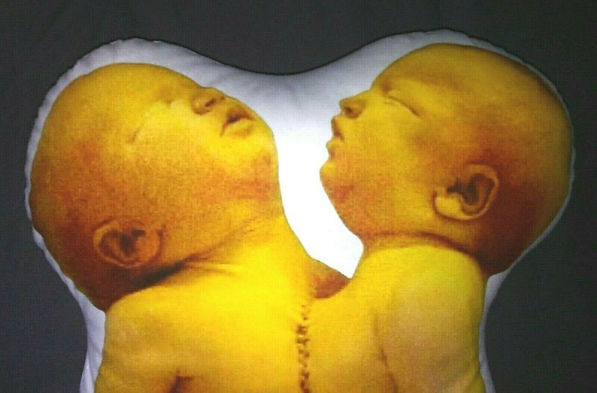 Conjoined Twins Life-sized Plush Pillow - Etsy