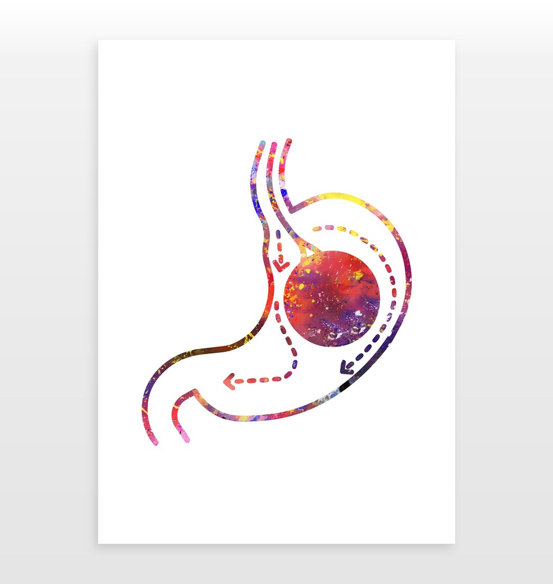 Stomach Balloon Poster - Human Anatomy Print - Watercolour Print - Etsy