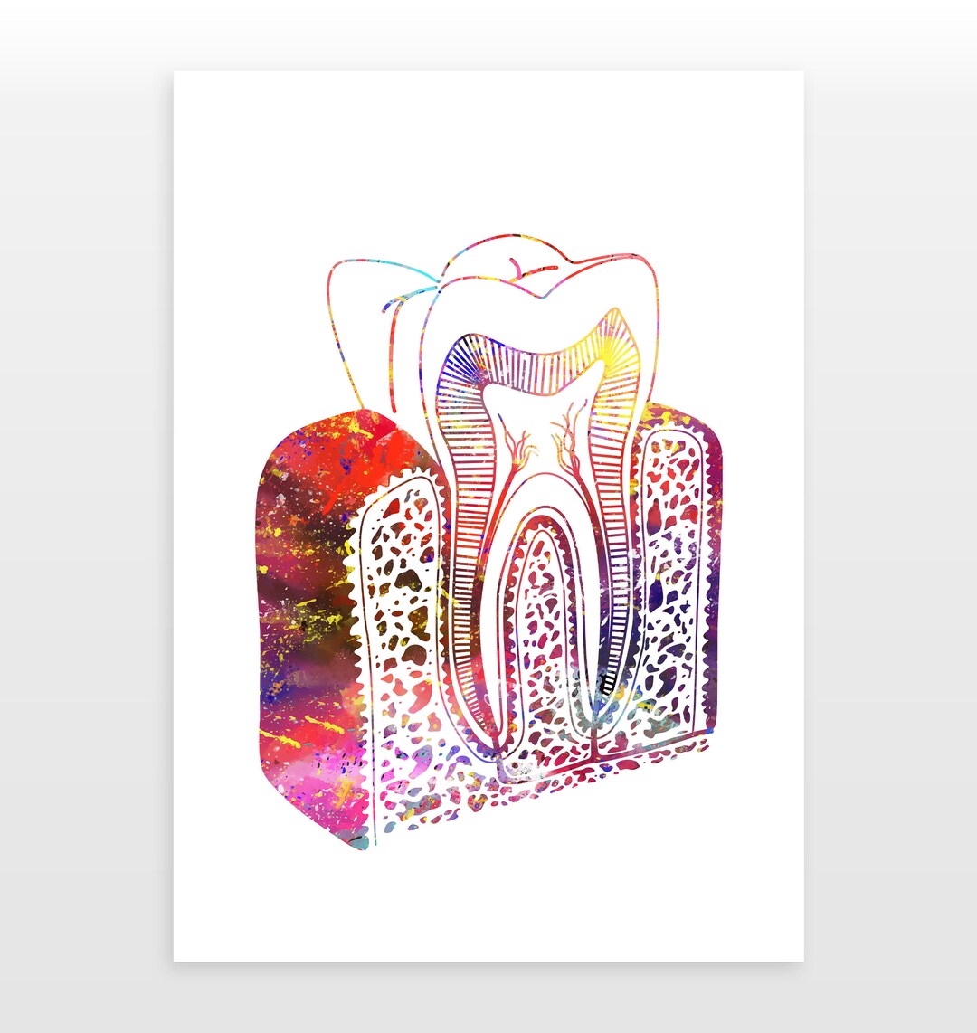Molar Tooth Poster - Dental Print - Watercolour Print - Etsy