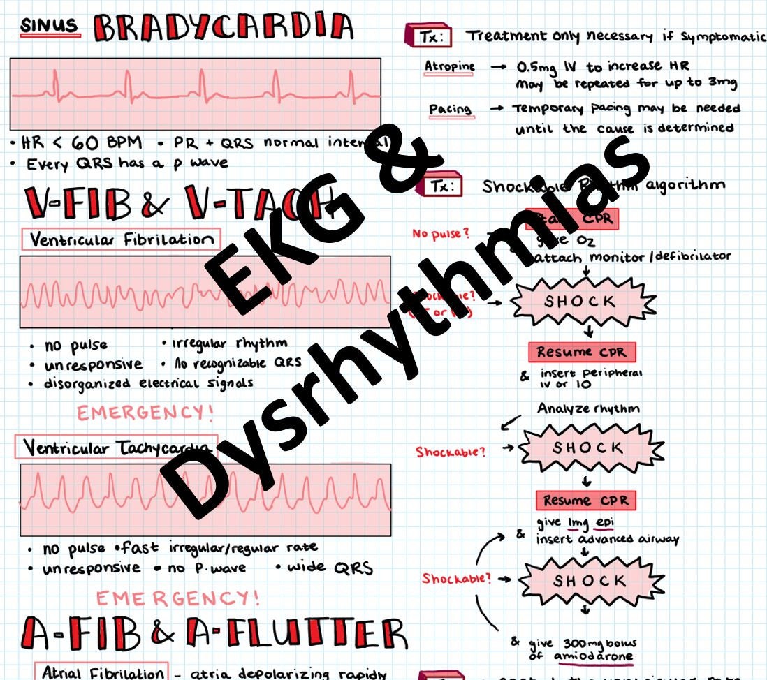 EKG & Dysrhythmia Interpretation Basics for Nurses and Nursing - Etsy