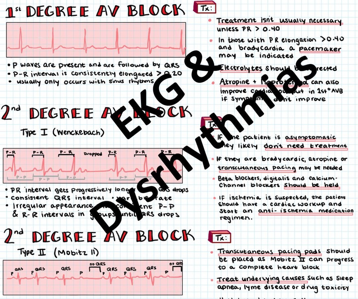 EKG & Dysrhythmia Interpretation Basics for Nurses and Nursing - Etsy