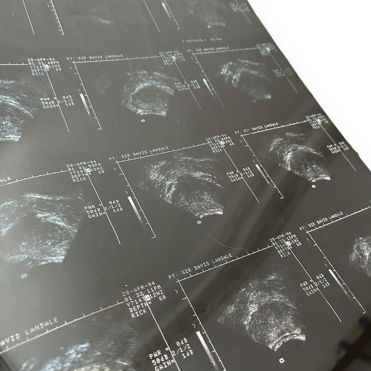 Vintage Hospital Human X-ray Ultrasound Scan Original Acetate Film - Etsy