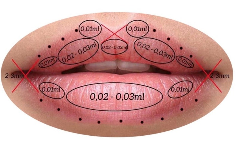 Lip Shaped Molds, Pressure Practice, Hyaluron Pen Training, Needless ...