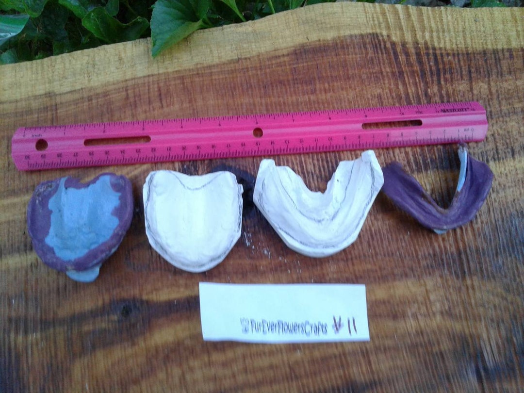 Dental Models/plaster Molds/dental Study Models - Etsy