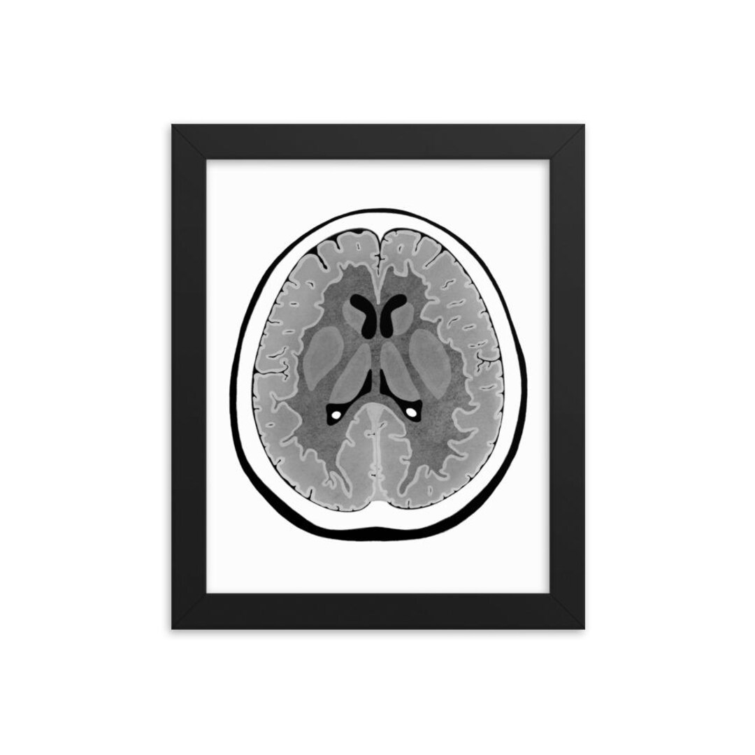 CT Brain Illustration Framed Poster, Neuroscience, Neurology Gifts ...