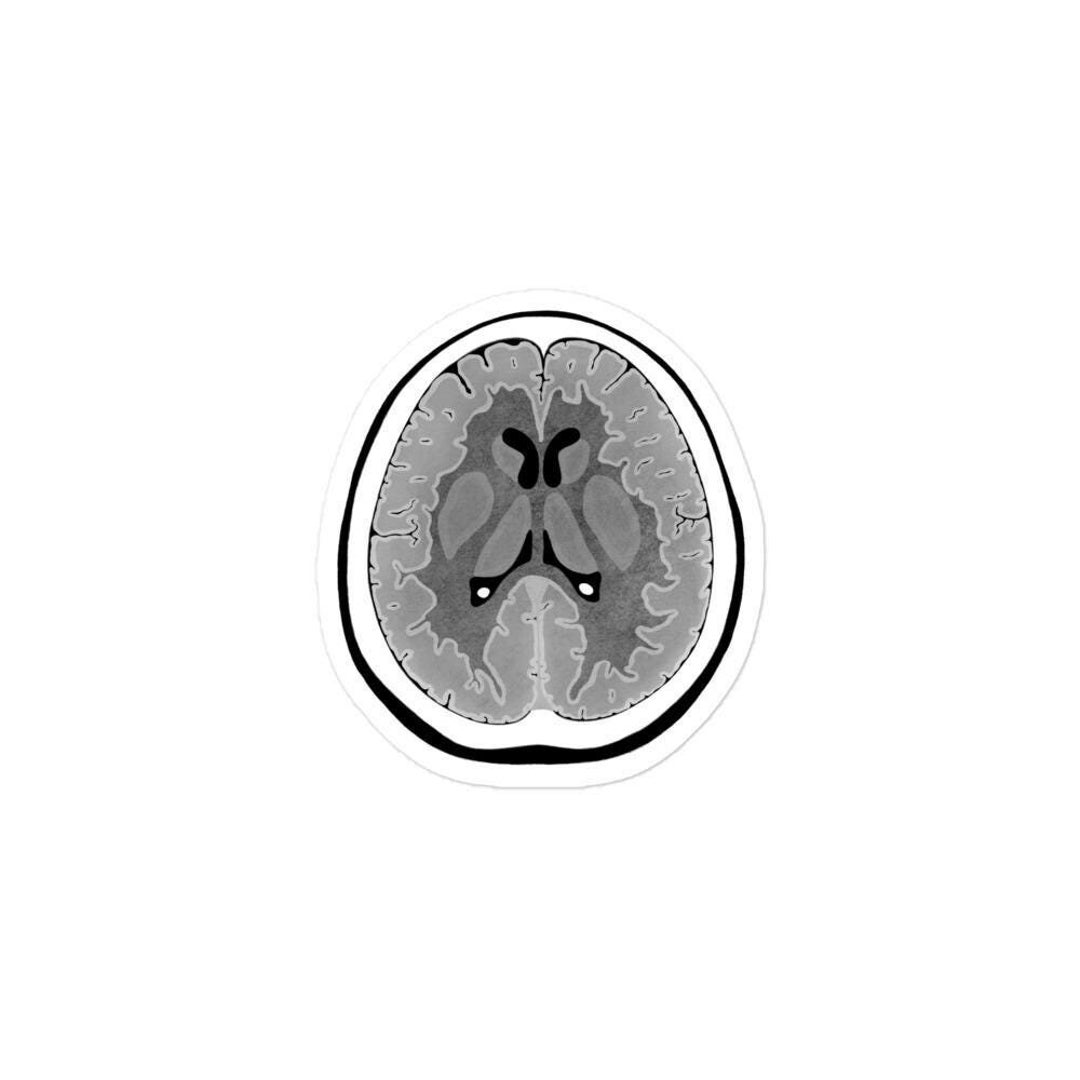 CT Brain Scan Illustration Kiss Cut Sticker, Neuroscience, Neurology ...