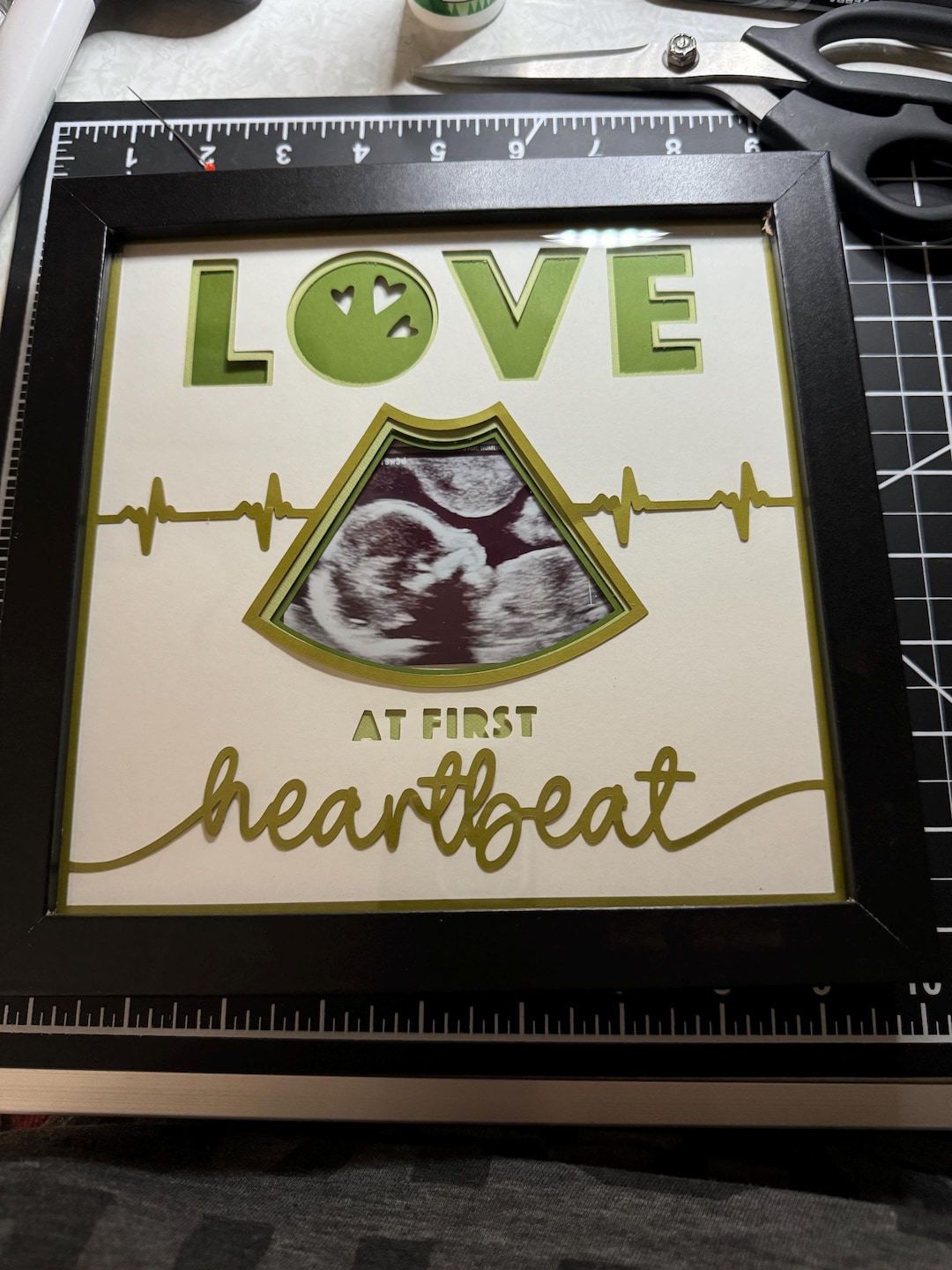 Ultrasound Shadow Box - Etsy