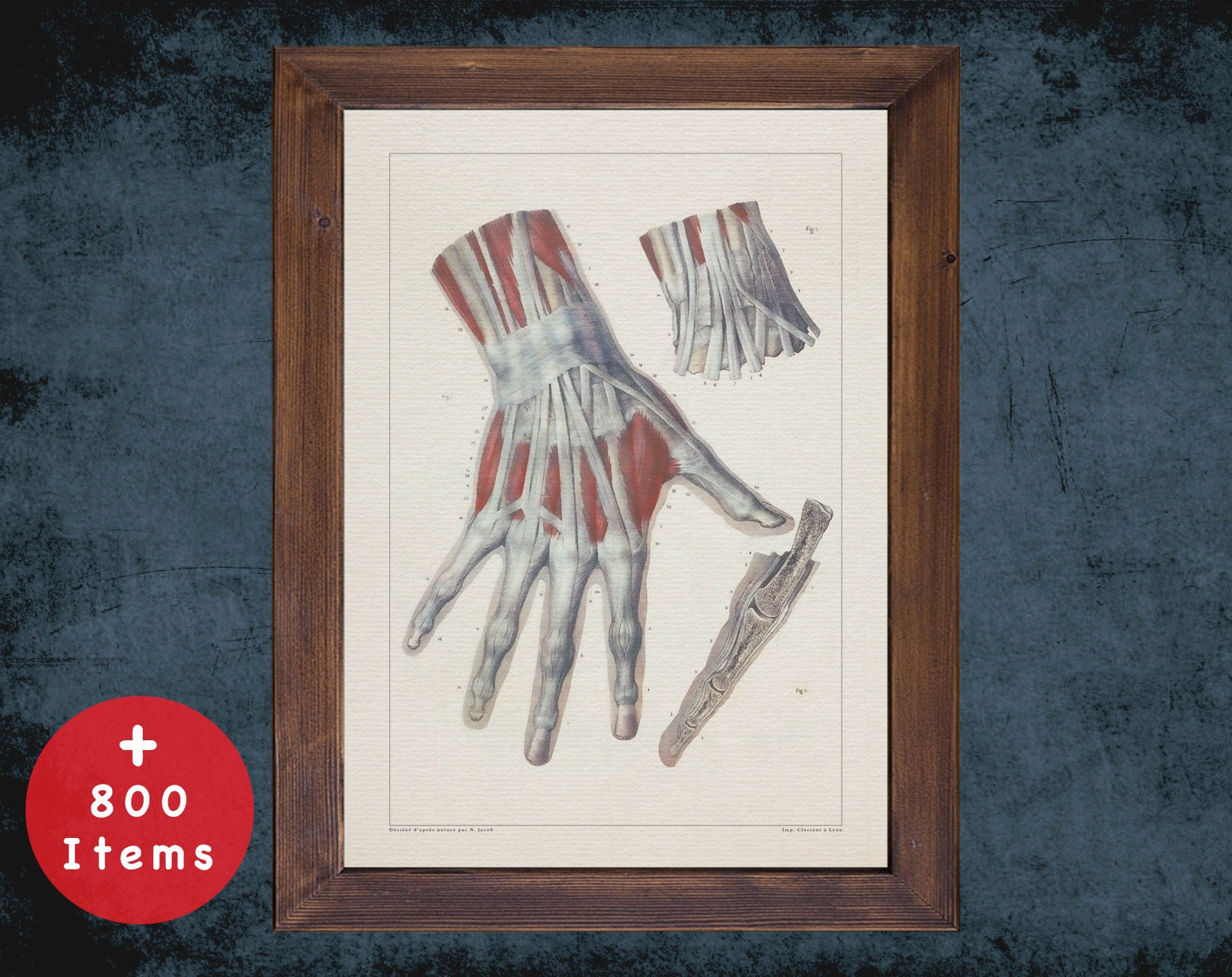 HAND TENDON LIGAMENT Anatomy Art Print for Medical Student Graduate ...