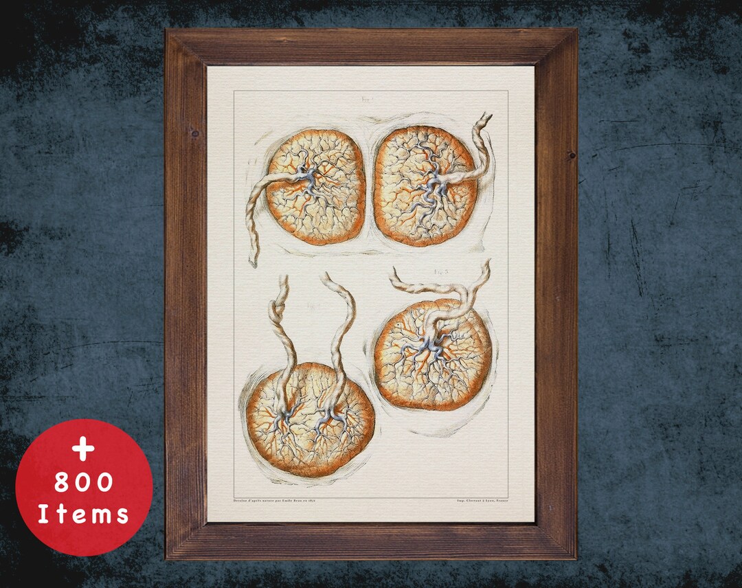 GEMELARY PLACENTA Anatomy Art Print for Medical Student Graduate ...