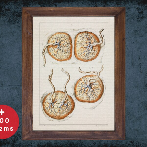 Placenta Print - Etsy