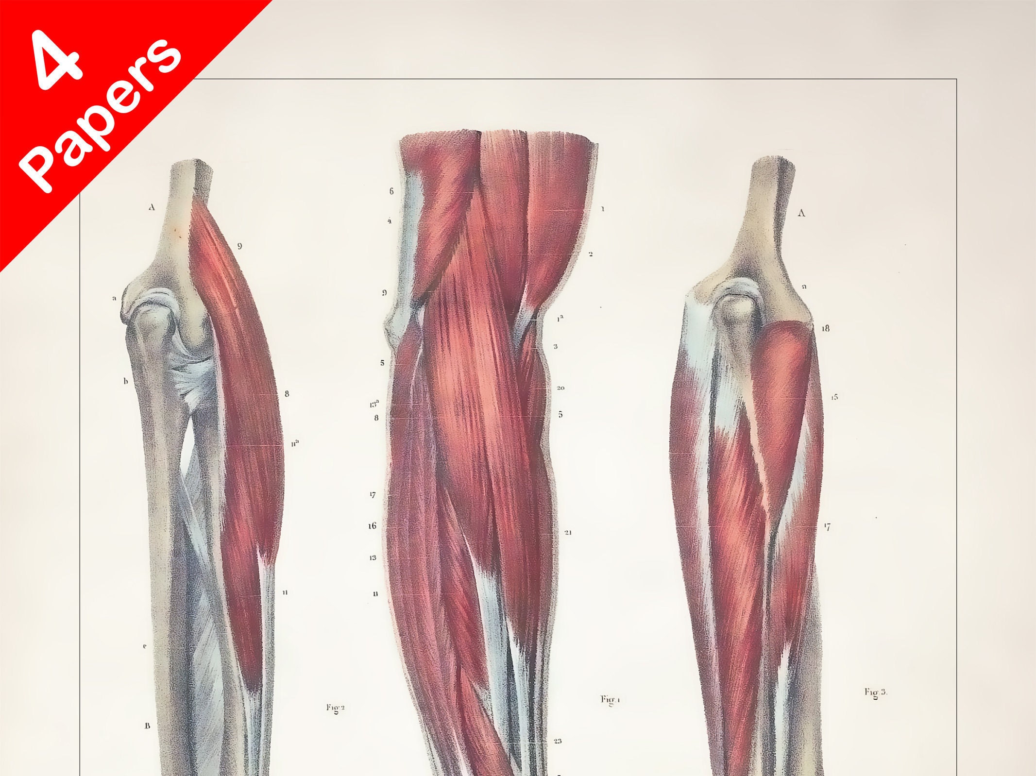 FOREARM ELBOW TENDONS Anatomy Art Print for Medical Student Graduate ...