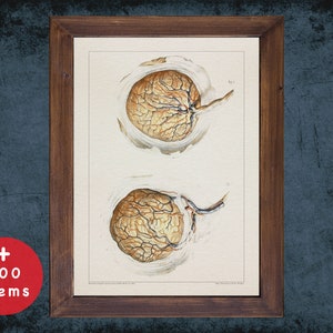 The Good Doctor HEAD BRAIN CEREBELLUM Anatomy Art Print for Medical ...