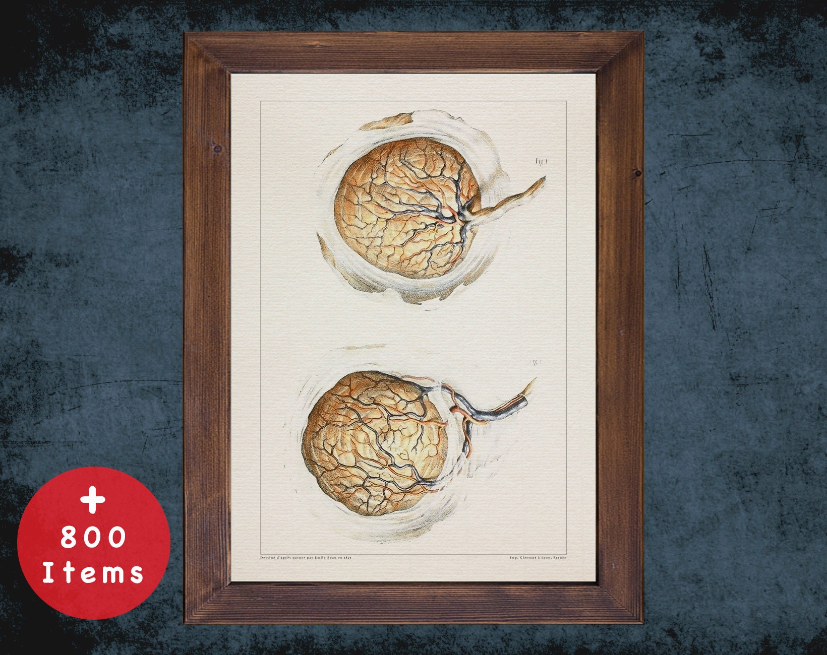 PLACENTA UMBILICAL CORD Anatomy Art Print for Medical Student Graduate ...