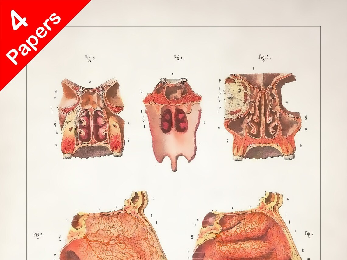 NOSE NASAL CONCHA Anatomy Art Print for Medical Student - Etsy