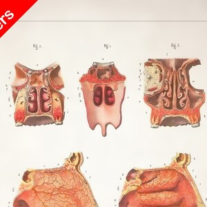 NOSE NASAL CONCHA Anatomy Art Print for Medical Student Graduate ...