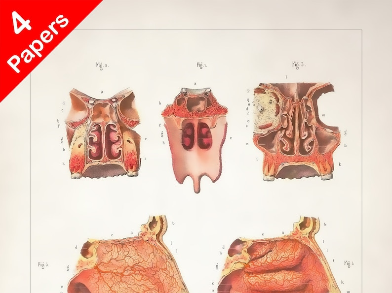 NOSE NASAL CONCHA Anatomy Art Print for Medical Student Graduate ...