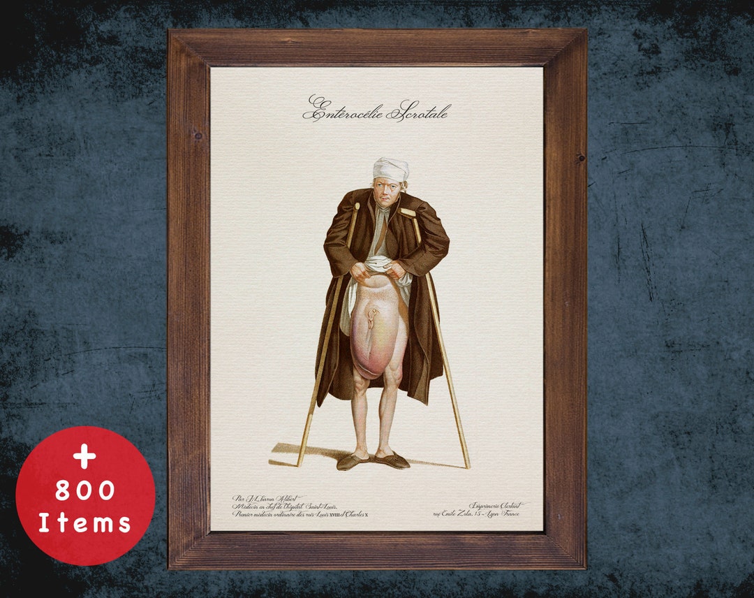 ENTEROCOELY SCROTAL Anatomy Art Print for Medical Student Gift ...