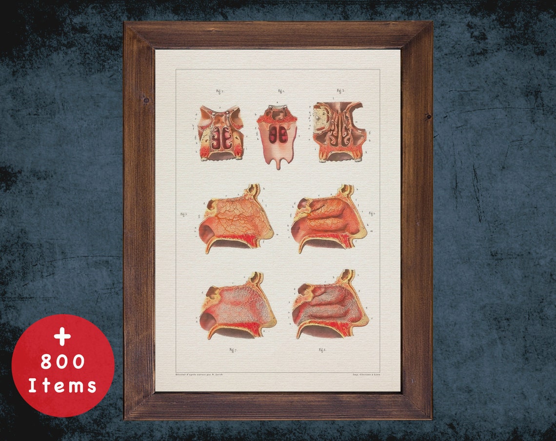 NOSE NASAL CONCHA Anatomy Art Print for Medical Student - Etsy