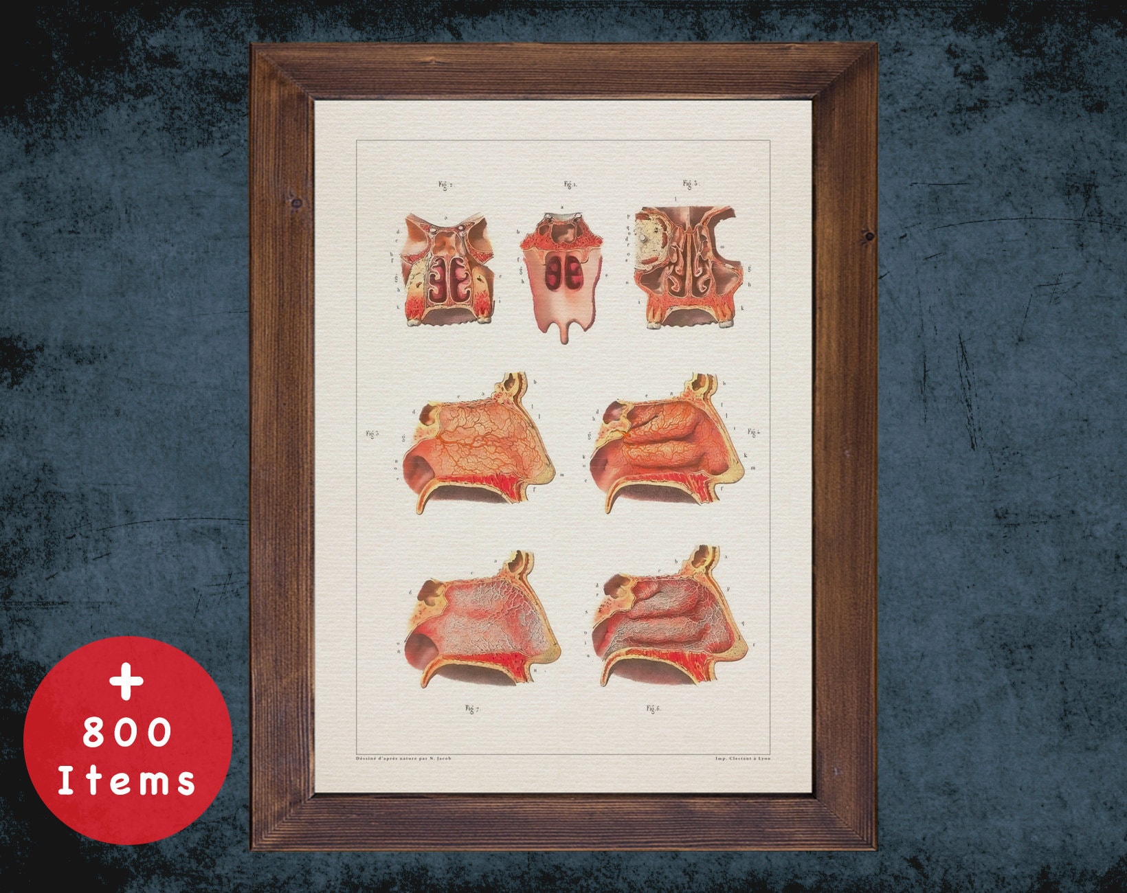 NOSE NASAL CONCHA Anatomy Art Print for Medical Student - Etsy