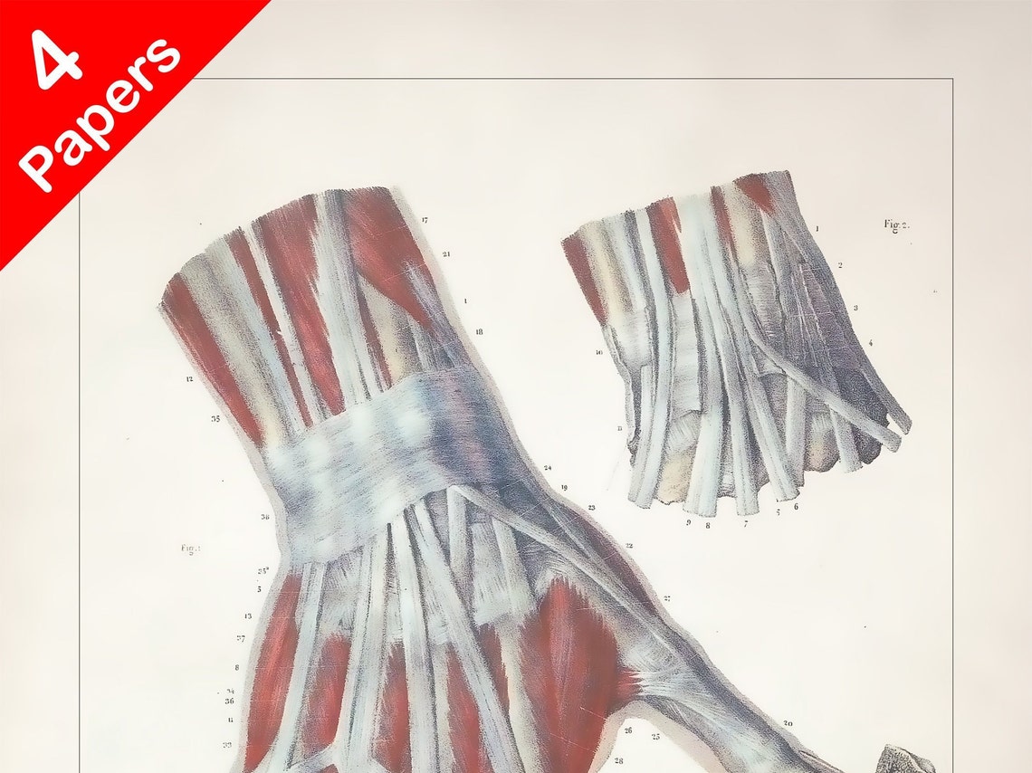 HAND TENDON LIGAMENT Anatomy Art Print for Medical Student Graduate ...