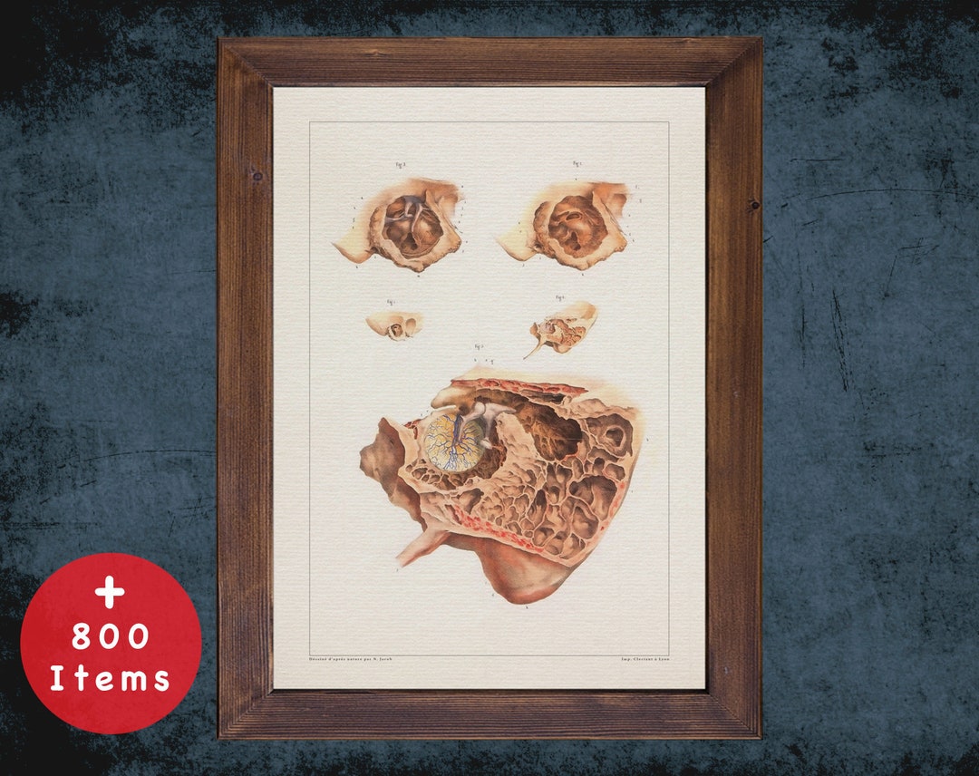 Tympanic Membrane Anatomy Art Print: Vintage Medical Decor - Etsy