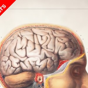 BRAIN MEDULLA OBLONGATA Anatomy Art Print for Medical Student Graduate ...