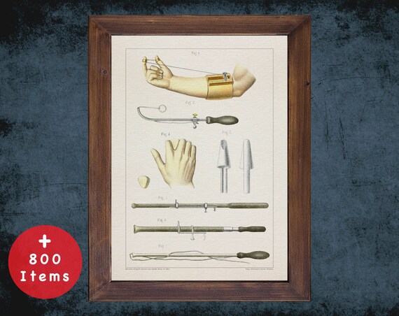 PELVIMETER OBSTETRICIAN TOOL Anatomy Art Print for Medical | Etsy