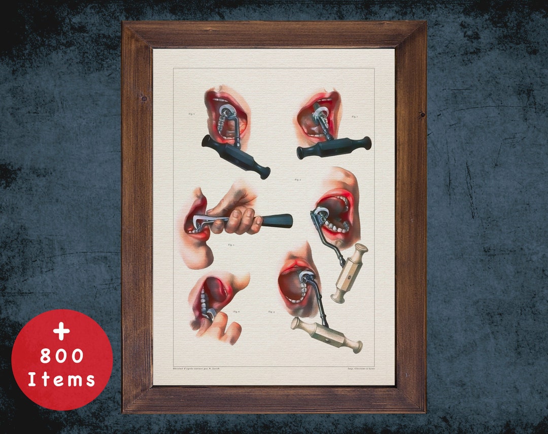 TOOLS TOOTH EXTRACTION Anatomy Art Print for Medical Student Graduate ...