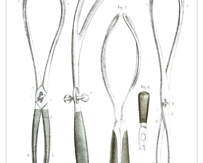 Chamberlen Forceps Anatomy Art Print: Midwife Obstetrics Decor - Etsy