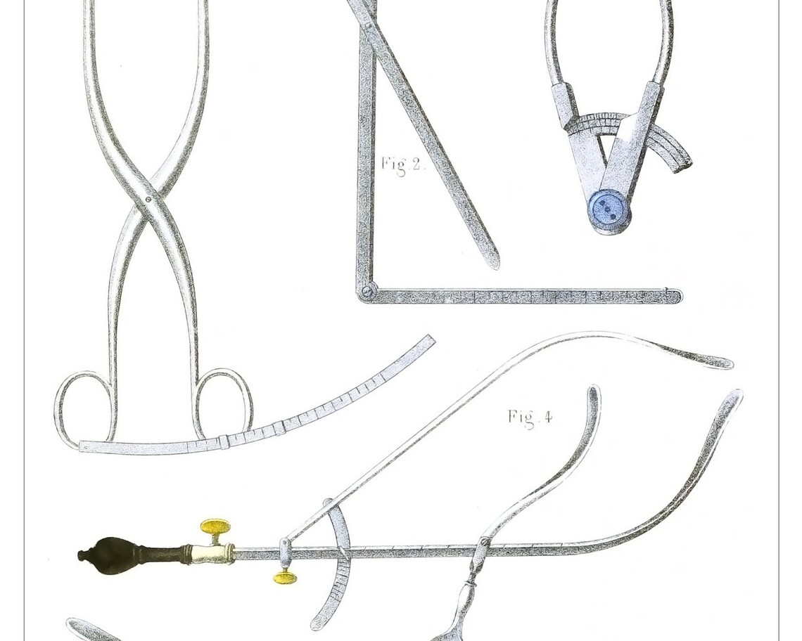 PELVIMETRE OBSTETRICIAN TOOLS Anatomy Art Print for Medical | Etsy