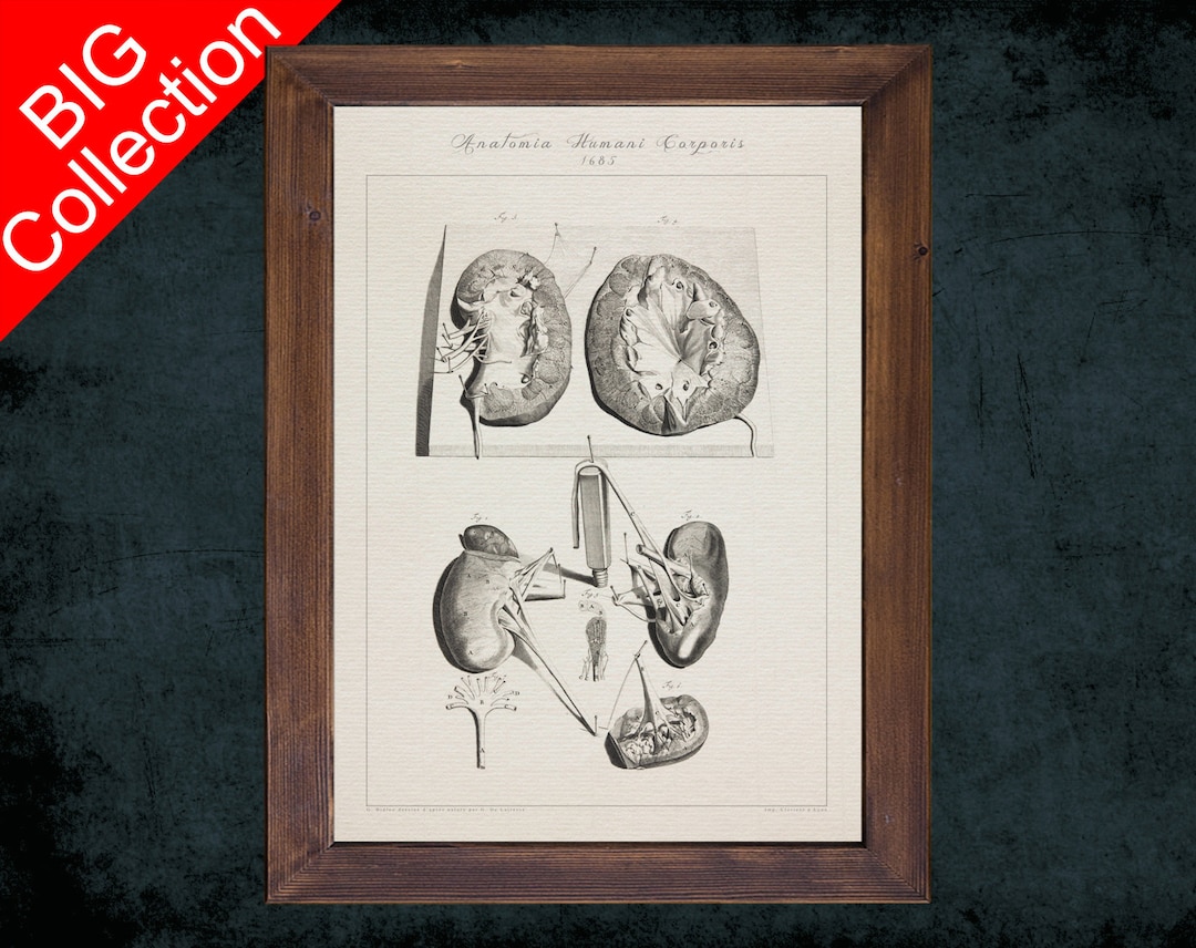 Human Anatomy Art Print KIDNEY RENAL ARTERY Anatomical Antique Sketch ...