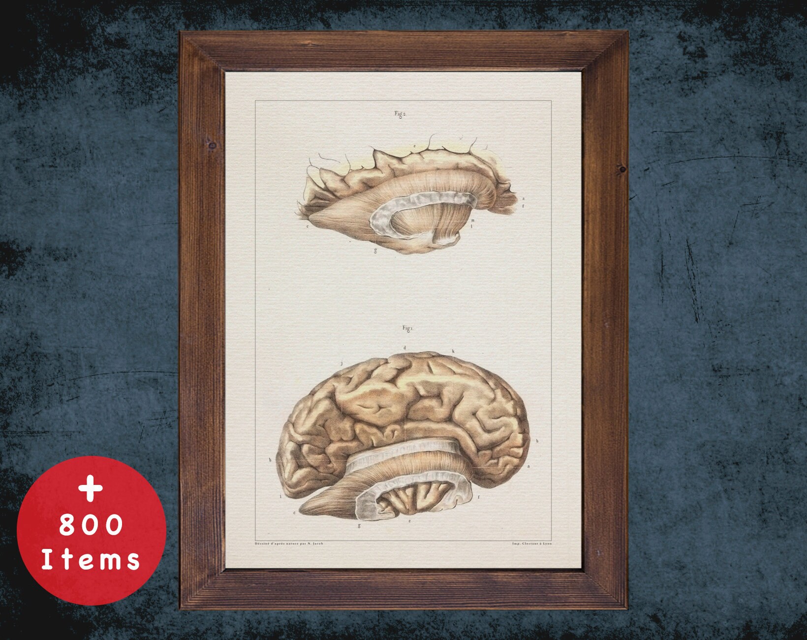 Anatomy Print, Set of 6 Posters, Gift for Neurosurgeon Doctor ...